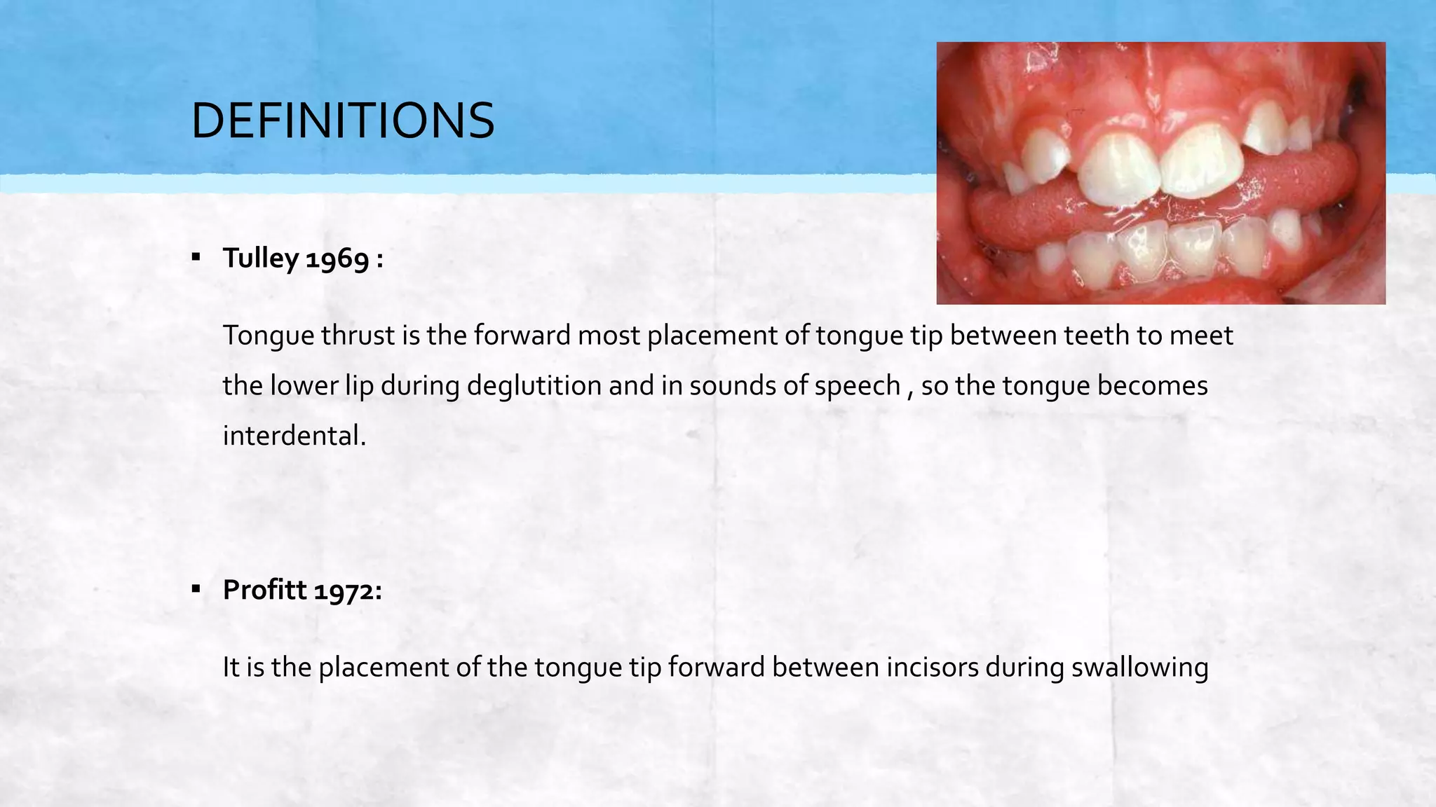Oral Habits in Children. Part II: Tongue thrusting,Mouth Breathing,Frenum thrusting,Cheek biting ...