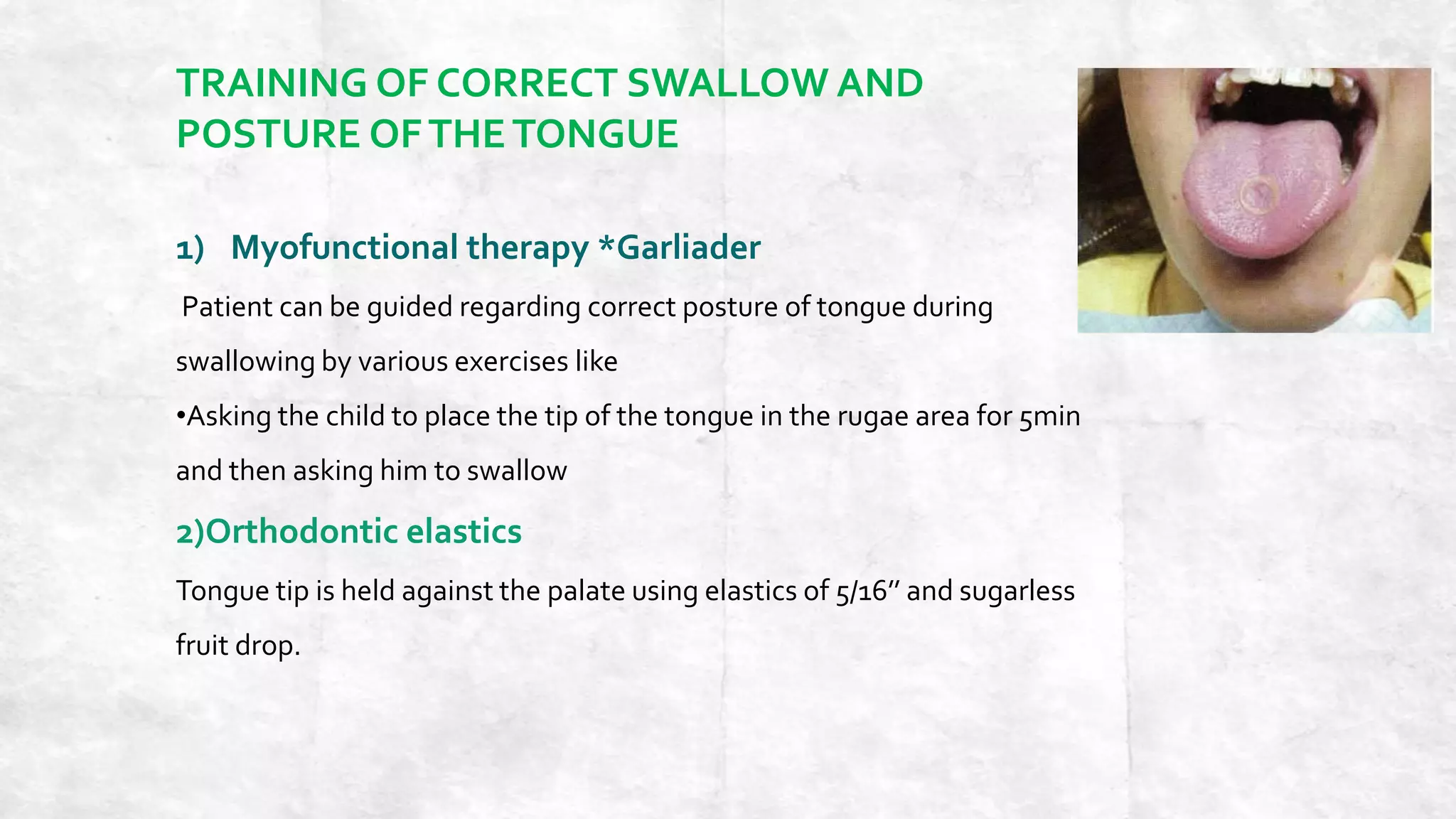 Oral Habits in Children. Part II: Tongue thrusting,Mouth Breathing ...