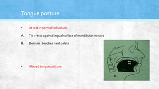 Oral Habits in Children. Part II: Tongue thrusting,Mouth Breathing,Frenum thrusting,Cheek biting ...