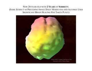 Brain scans | PPT