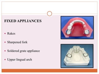 HABITS IN ORTHODONTICS.ppt