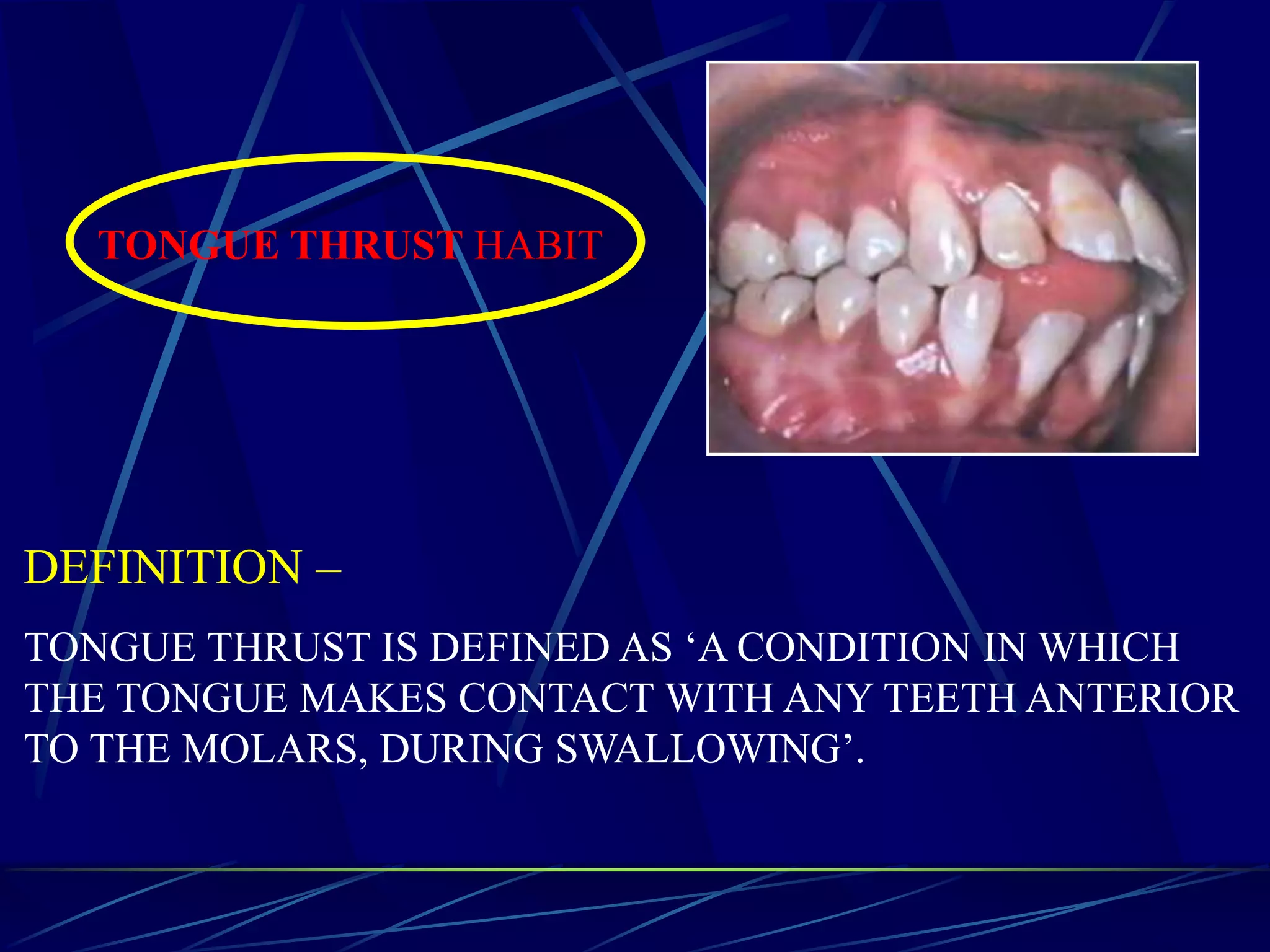 Habits in Orthodontics | PPT