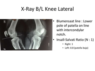 Habitual dislocation of patella | PPTX