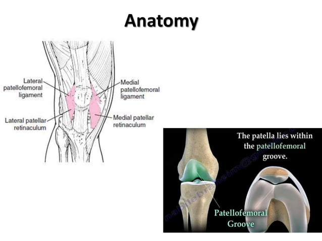 Habitual dislocation of patella | PPTX