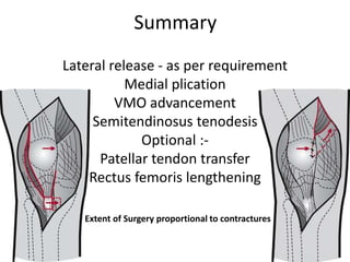 Habitual dislocation patella | PPTX | Death, Injury, or Military ...