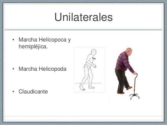 Habitus exterior orr