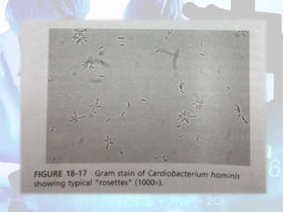 Hacek report iin bacte | PPTX