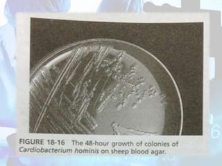 Hacek report iin bacte | PPTX