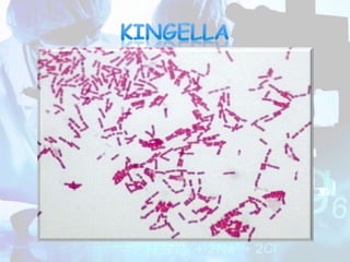 Hacek report iin bacte | PPTX