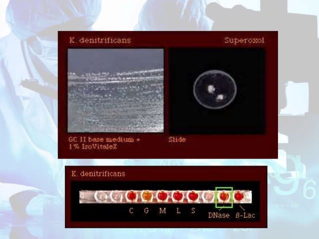 Hacek report iin bacte | PPTX