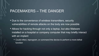 Hacking Into Medical Devices | PPTX