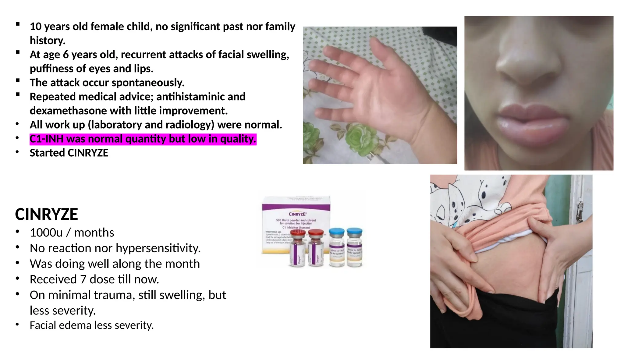 Hereditary angioedema managment2024.pptx