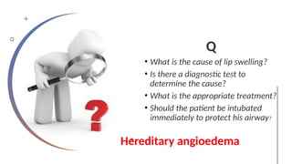 Hereditary angioedema managment2024.pptx