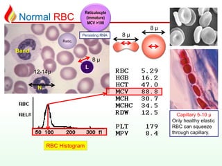 Haem11 Anemia Introduction. | PPT