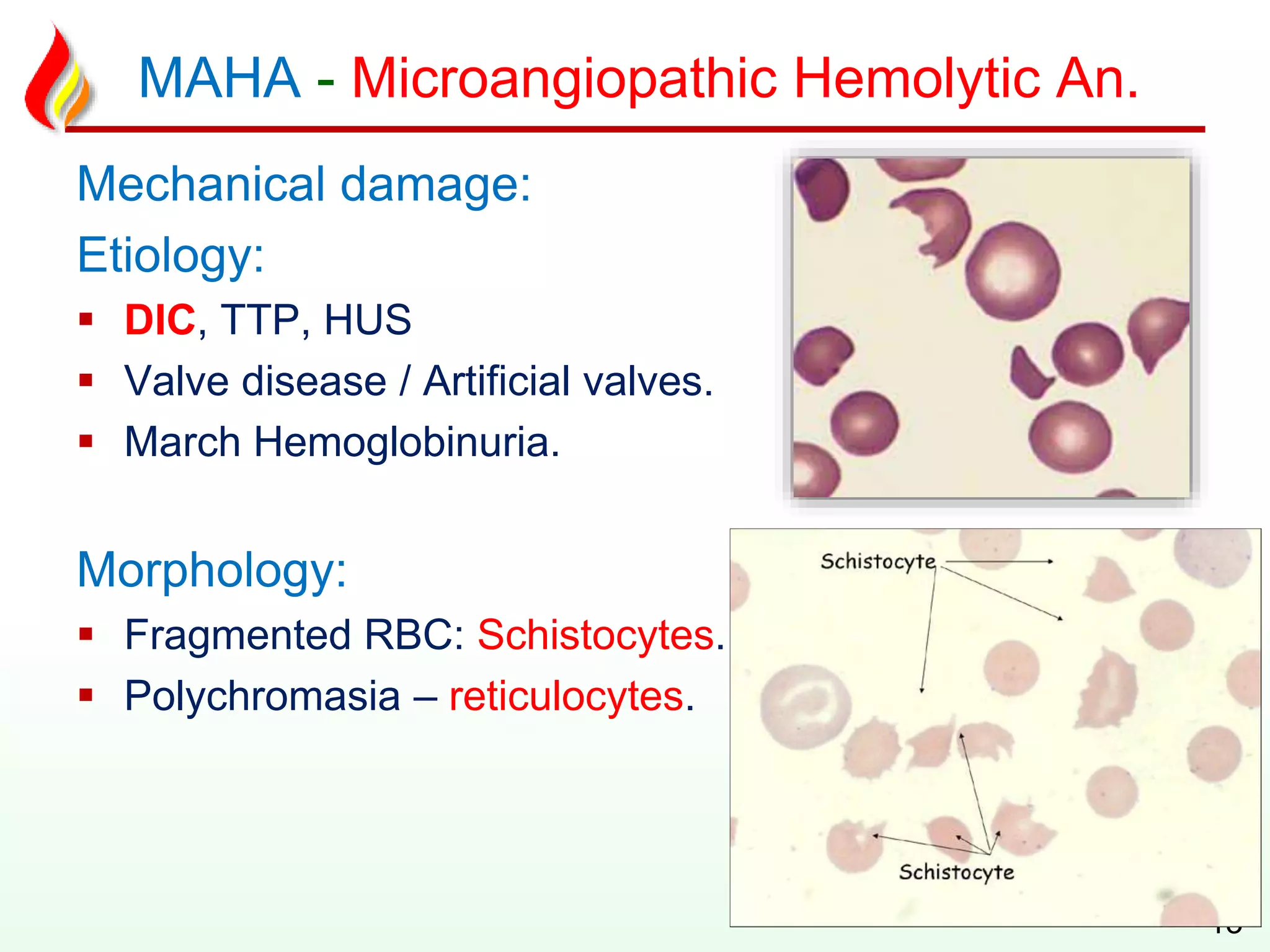 Haem13 hemolytic anemia - acquired | PPTX