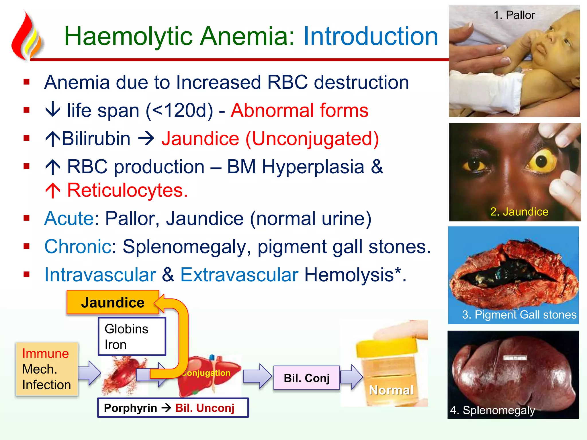 Haem13 hemolytic anemia - acquired | PPTX