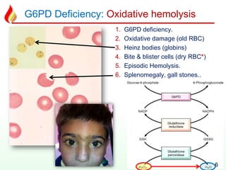 Anemia 4 hemolytic congenital | PPTX