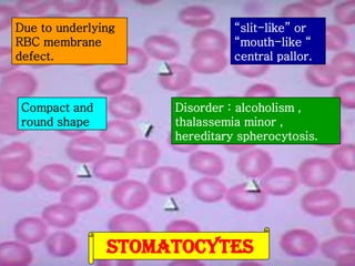 normal and abnormalities in red blood cell | PPTX
