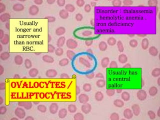 normal and abnormalities in red blood cell | PPTX
