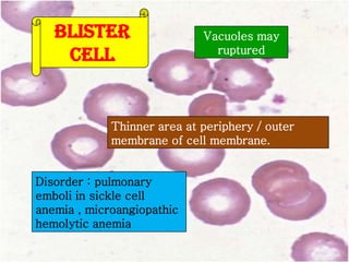 normal and abnormalities in red blood cell | PPTX