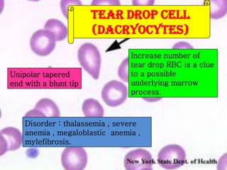 normal and abnormalities in red blood cell | PPTX
