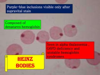 normal and abnormalities in red blood cell | PPTX