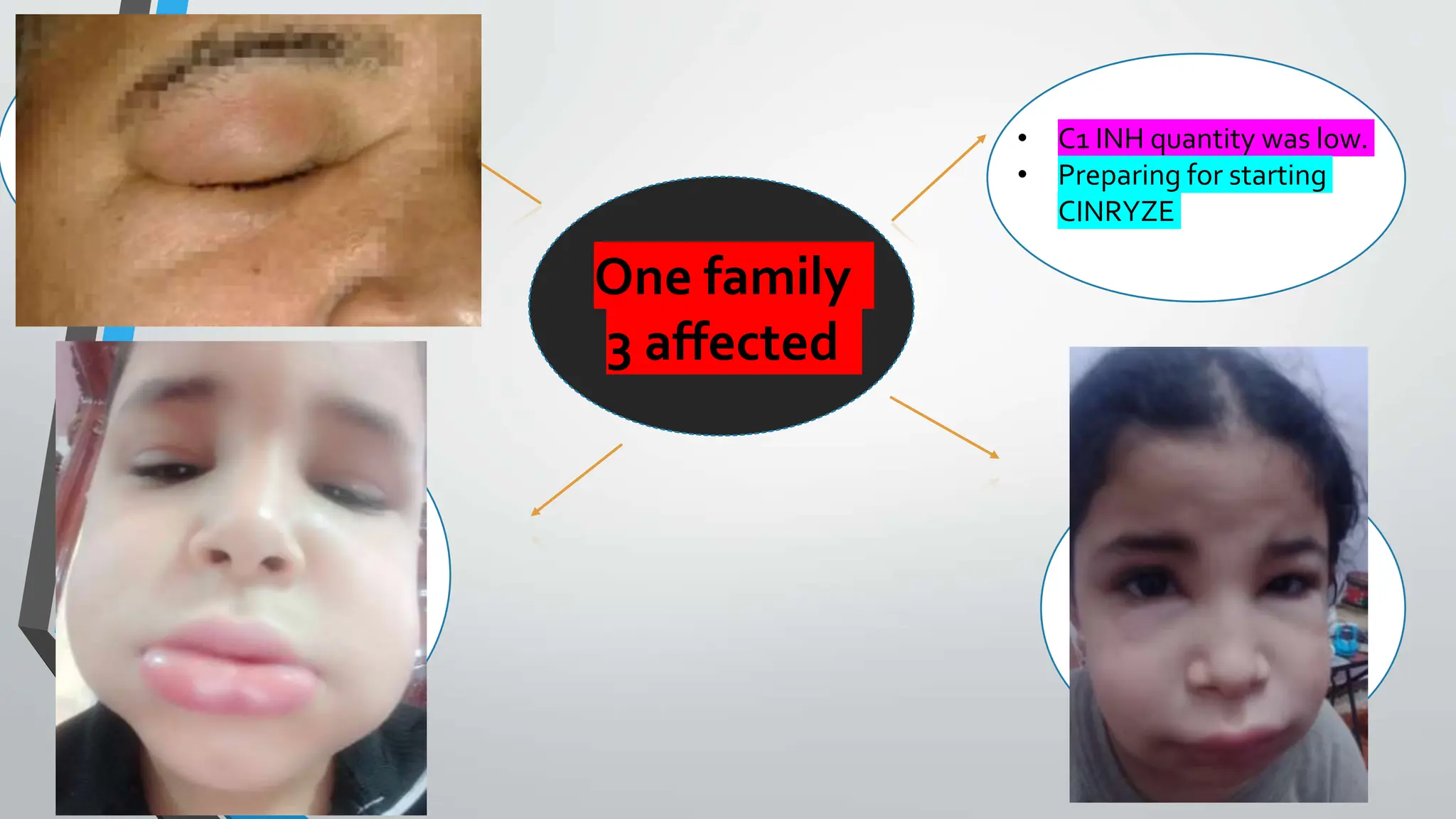 Hereditary angioedema managment last.pptx