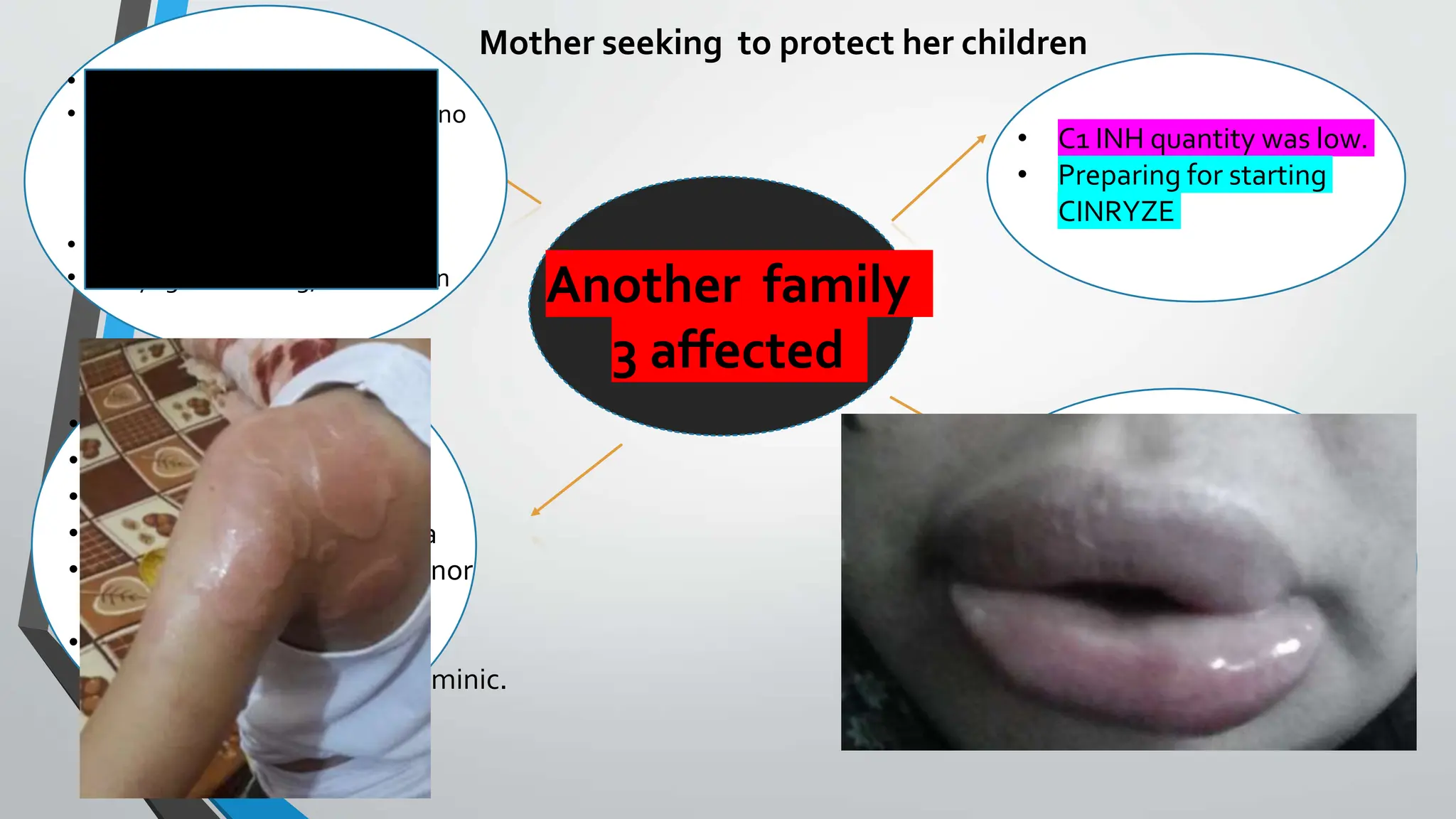 Hereditary angioedema managment last.pptx