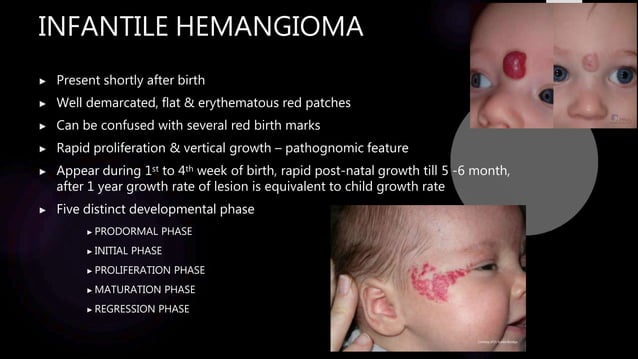 haemangiomaandvascularanomelies-160321030809.pptx