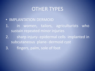 Haemangioma , lymphangioma and dermoid cyst | PPTX