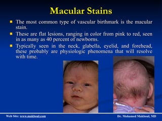 Macular Stains