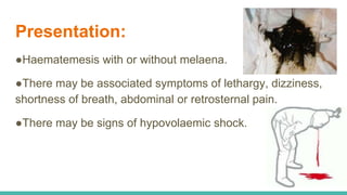 Haematemesis and malena | PPTX