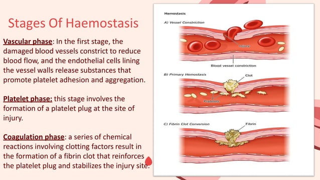 hemostasis and thrombosis | PDF