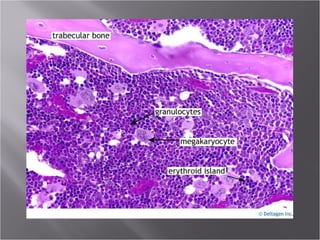 Haematological Malignancies | PPT