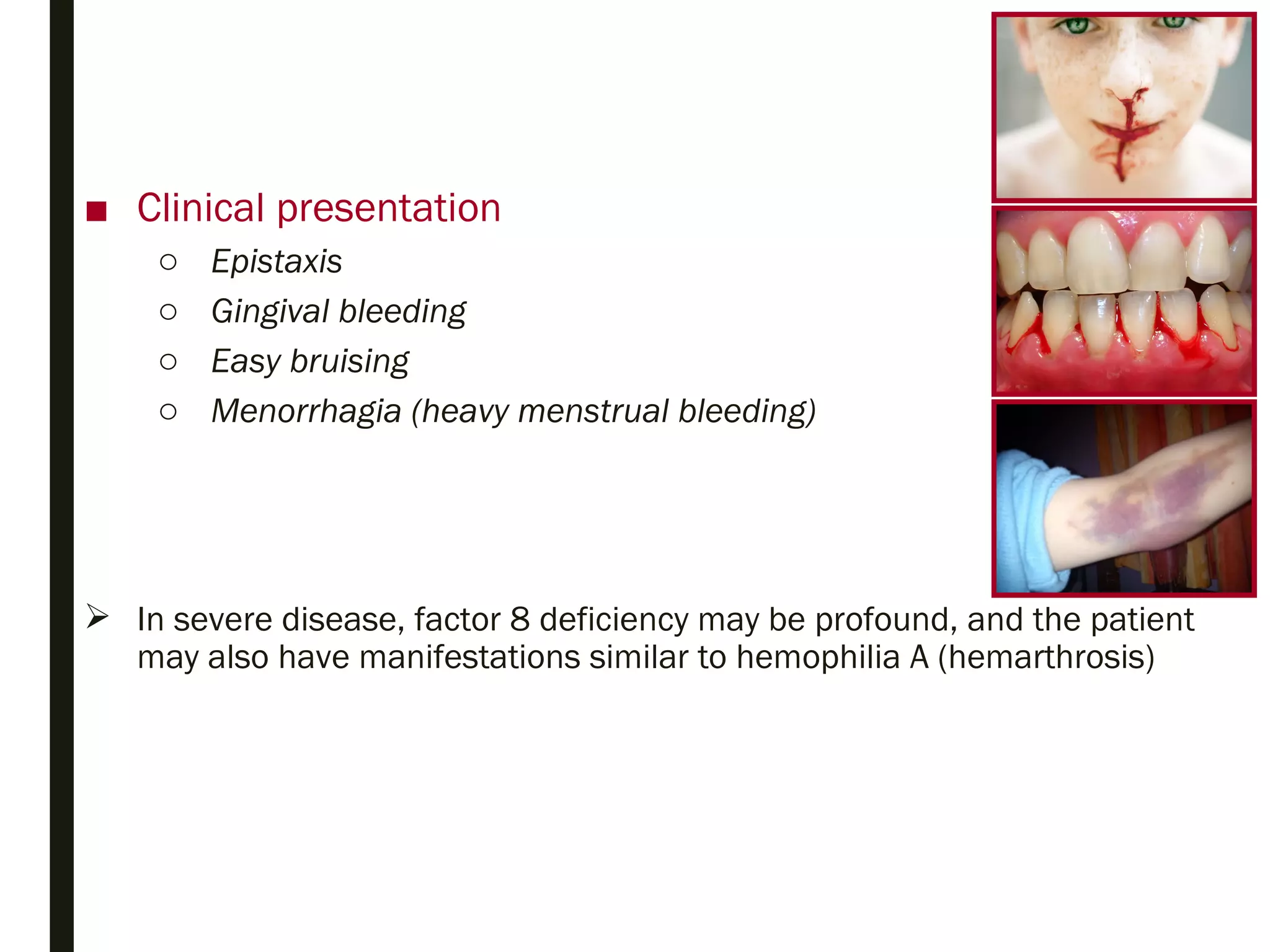 Hematological Disorders - Bleeding Disorders | PPT