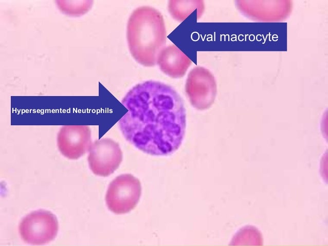 Haematology