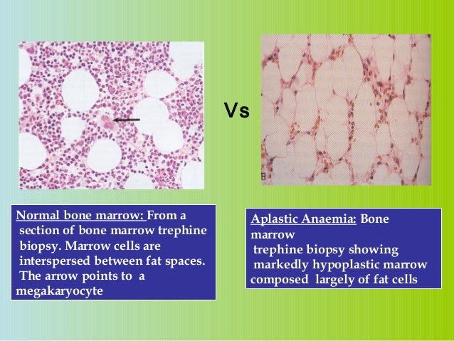 Haematology