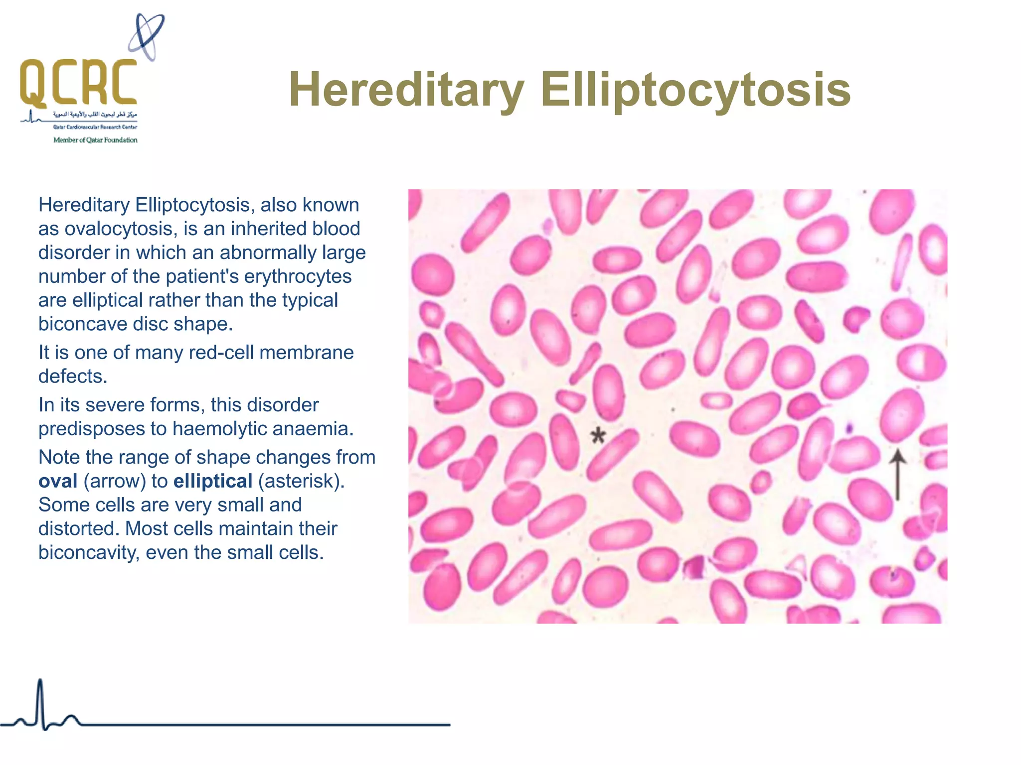 Haematopathology: Introducing the various types of anaemias and red ...