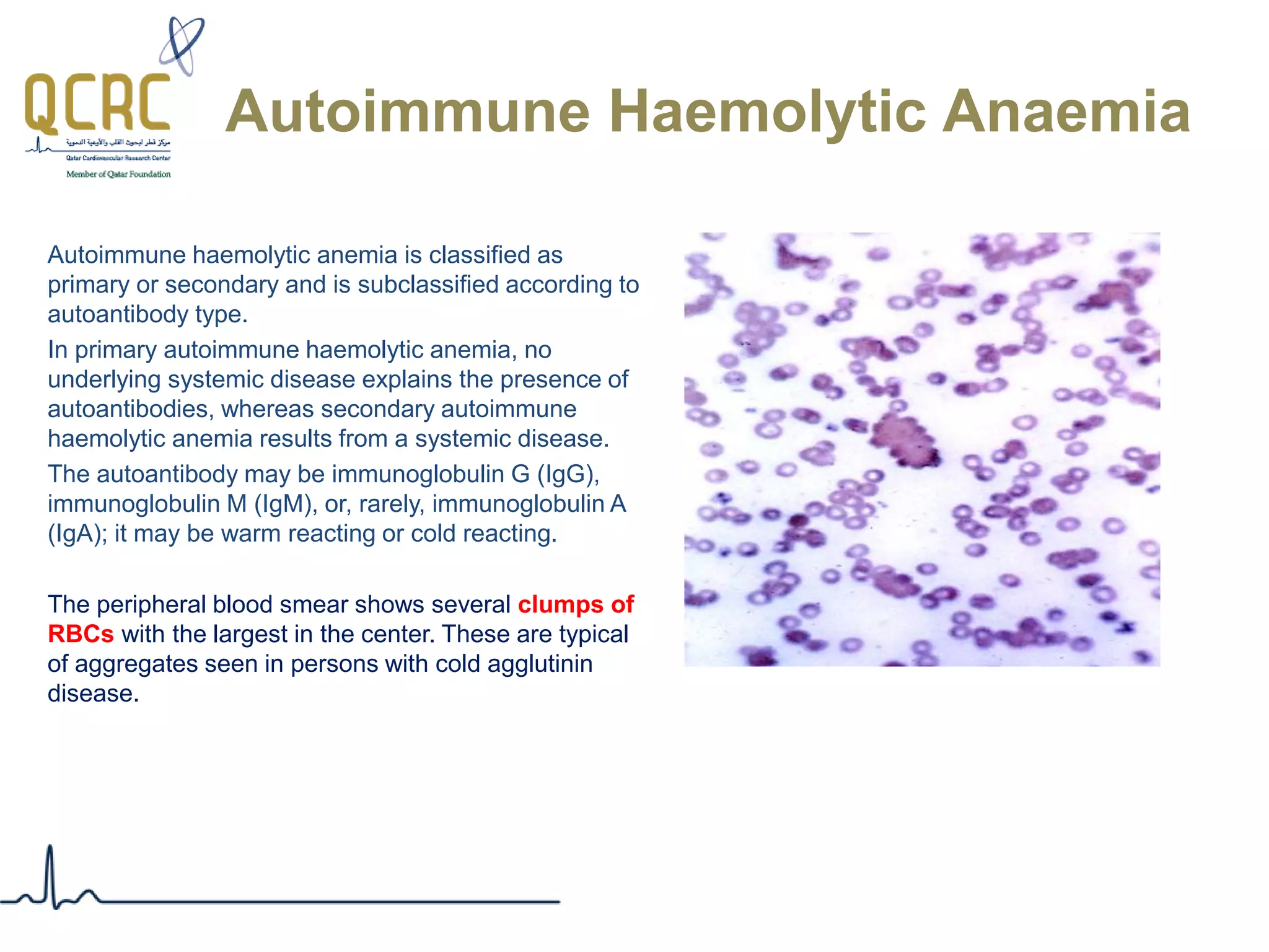 Haematopathology: Introducing the various types of anaemias and red ...
