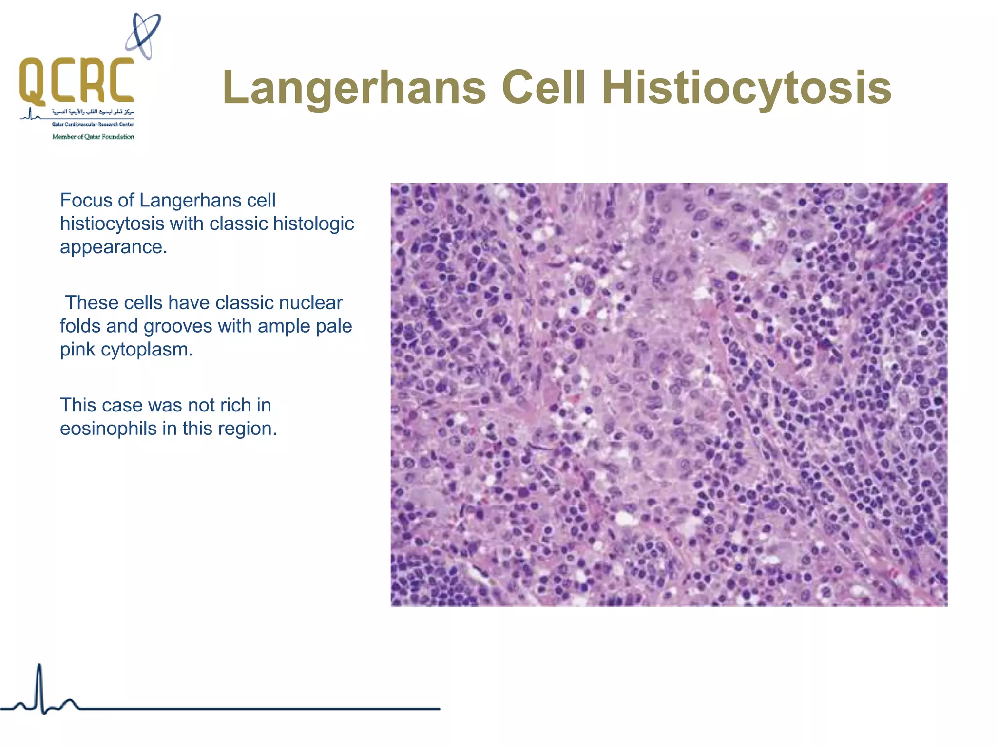 Haematopathology: Introducing the various types of anaemias and red ...