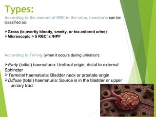 Haematuria | PPT