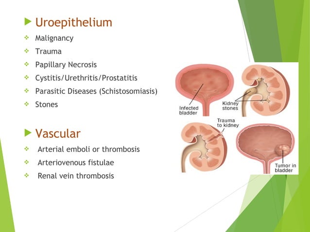 Haematuria | PPT | Blood Disorders | Diseases and Conditions