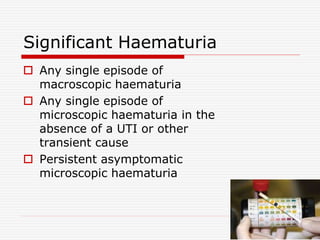 haematuria.ppt