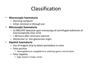 Haematuria & urinary tract malignancy | PPT