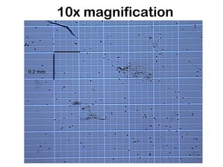 Hemocytometer Under Microscope