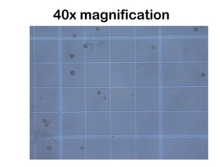 Hemocytometer Under Microscope
