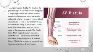 haemodialysis.pptx Best Education Ppt For Use Study | PPTX