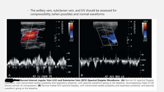Haemodialysis fistula doppler | PPTX