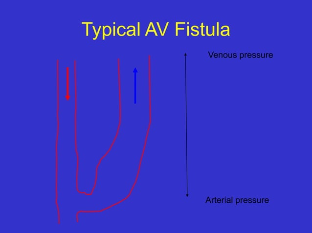 Haemodialysis Fistula Intervention - Dr Ralph Jackson.ppt