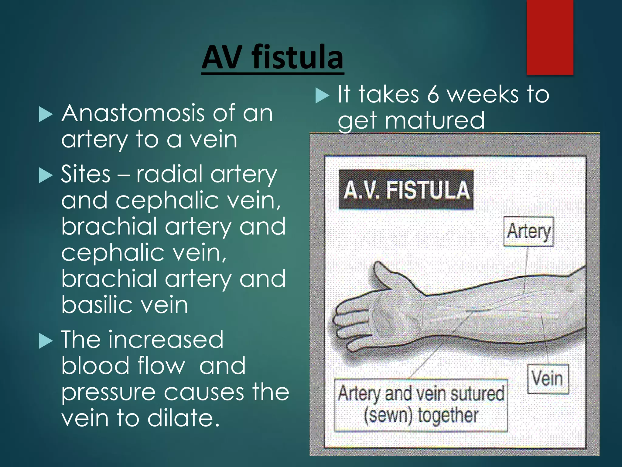 Haemodialysis ppt by roy | PDF
